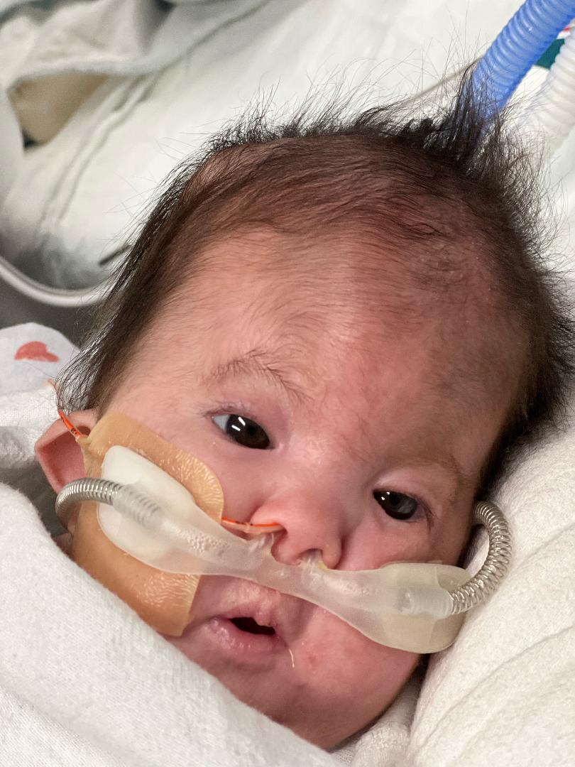 Delilah's Story | Trisomy 18 Foundation